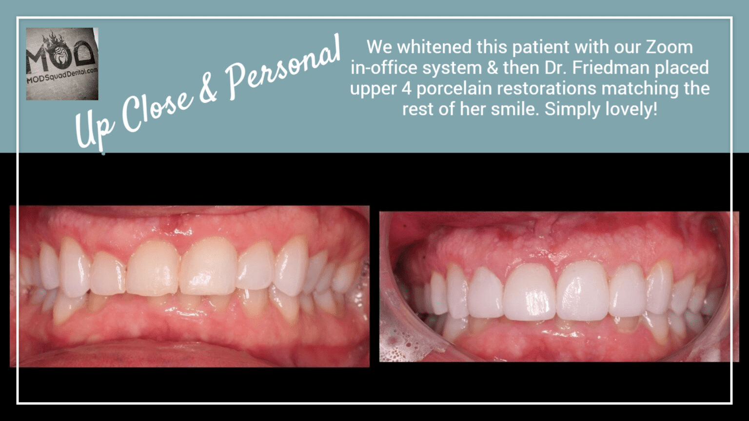 Up Close and Personal... | MOD Squad Dental