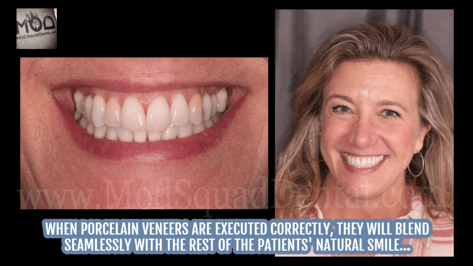 Featured Smile of the Day :) | MOD Squad Dental